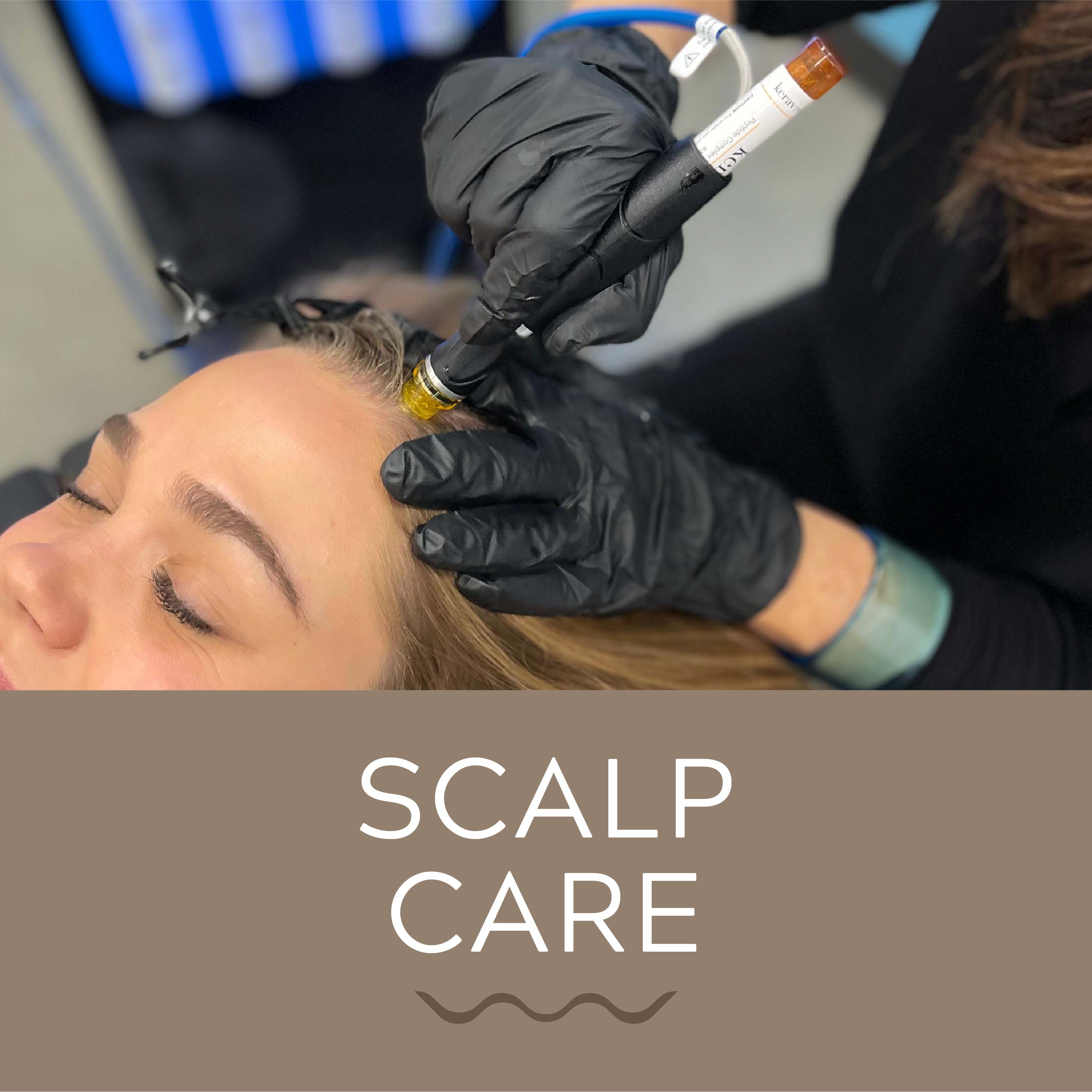 SCALP Treatments – BioRevive Med & Wellness Spa